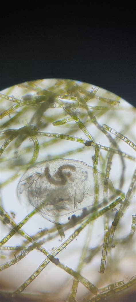 Found A Bunch Of Stuff In Filamentous Algae R Microscopy