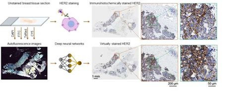 Deep Learningbased Virtual Staining Of Tissue Facilitates Rapid