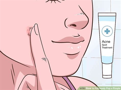 Ways To Painlessly Pop A Pimple WikiHow