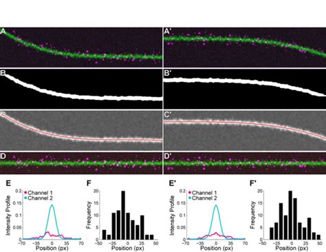 10 Processing Steps And Exemplary Outcome Of The Elongated Shape Download Scientific Diagram