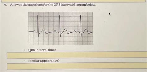 Solved E Answer The Questions For The QRS Interval Diagram Chegg Com