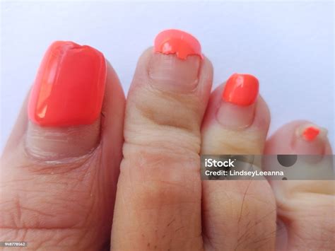 심하게 못생긴 여자의 발 긴 연어 색된 발톱을 신랑 페디큐어가 필요 합니다 연체 페디큐어입니다 흰색 배경에 고립 발톱에 대한 스톡 사진 및 기타 이미지 Istock