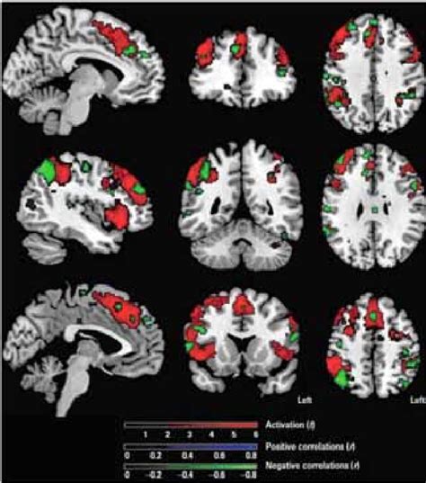 SPM Maps Of Significant Correlations P