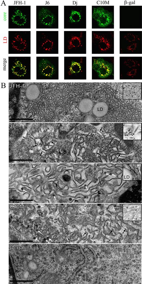 Subcellular Distribution Of The Various Hcv Core Proteins Expressed