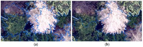 An Individual Tree Segmentation Method That Combines Lidar Data And Spectral Imagery