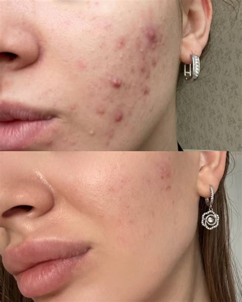 Косметика догляд за обличчям волоссям та тілом Україна On Instagram Нічний оновлюючий