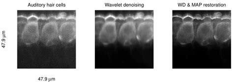 Example Of Wavelet Denoising Followed By M A P Estimation Left Focal