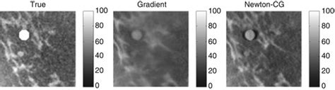Methods For Ill Posed Problems Radiology Key
