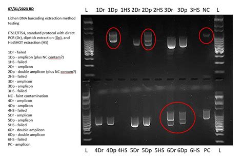 Interpreting Electrophoresis Gels Bento Lab