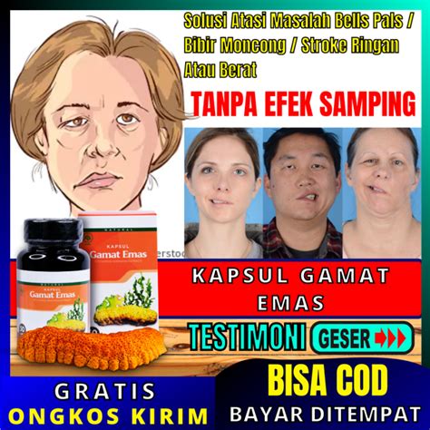Obat Bells Palsy Obat Bibir Miring Muka Mencong Sebelah Kanan Kiri Bel Pals Gangguan