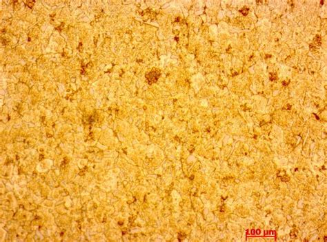 Comparison Of The Microstructure Of Cooling Slope Casting And Download Scientific Diagram