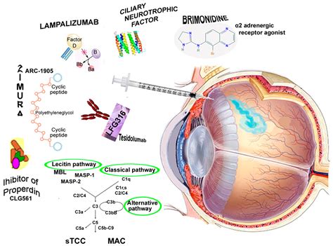 Intravitreal Injection Therapy Icare Surgical Centre