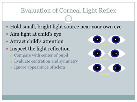 Ppt Strabismus What You Need To Ask And Know Powerpoint Presentation