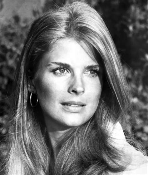 📺 Candice Bergen Tänder Gamlanya Före Och Efter