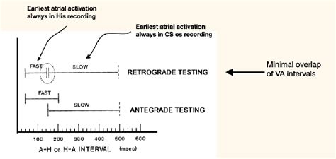 The Ranges Of Av Nodal Conduction Times Representing The Fp Or Sp Based Download Scientific