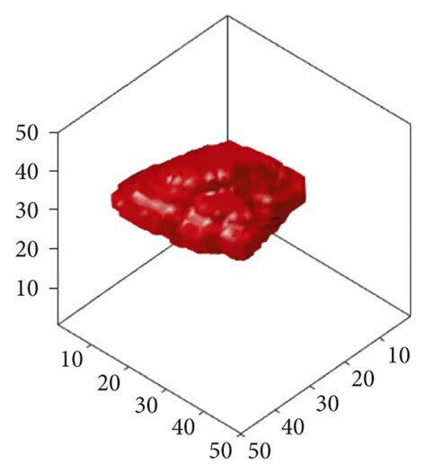 the segmentation results of computer simulated images with 30 noise