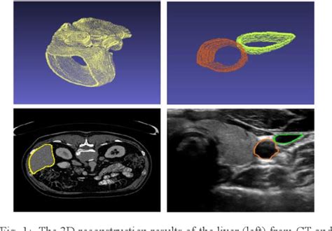 Figure From D Reconstruction Of Medical Images With Transformer Semantic Scholar