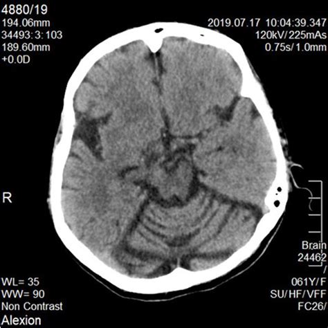 Schematic Representation Of The Detection Cascade 3 Download Scientific Diagram