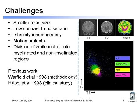 Automatic Segmentation Of Neonatal Brain Mri Marcel Prastawa