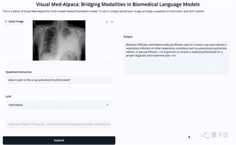 剑桥华人团队搞出多模态医学大模型！单个消费级显卡就能部署，借鉴斯坦福「羊驼」而来 知乎
