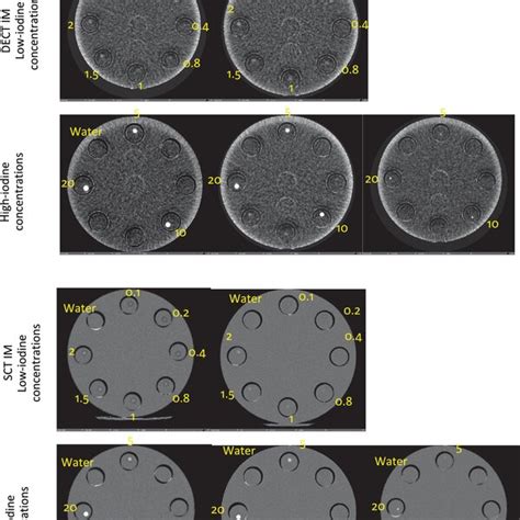 Dual‐energy Computed Tomography Dect Iodine Map Im Images