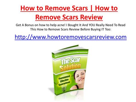PPT How To Remove Scars PowerPoint Presentation Free Download ID 12904