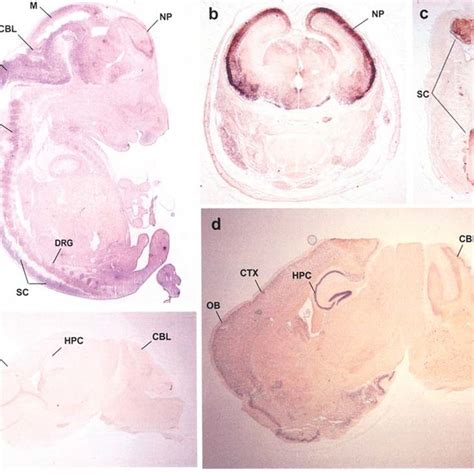 Expression Analysis Of Iqsec2 Mrna During Embryonic And Postnatal Download Scientific Diagram