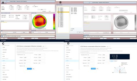 A Initial Page Of A Corneal Topography Guided Surgery Following The Download Scientific