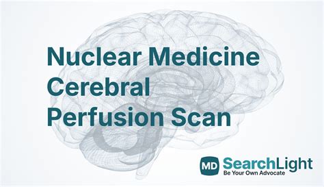 Nuclear Medicine Cerebral Perfusion Scan Cerebral Perfusion Scan Md Searchlight