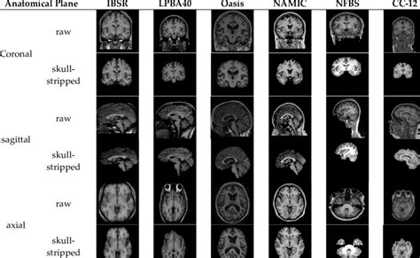 Sualizing Anatomical Planes Of Publicly Available Datasets Download