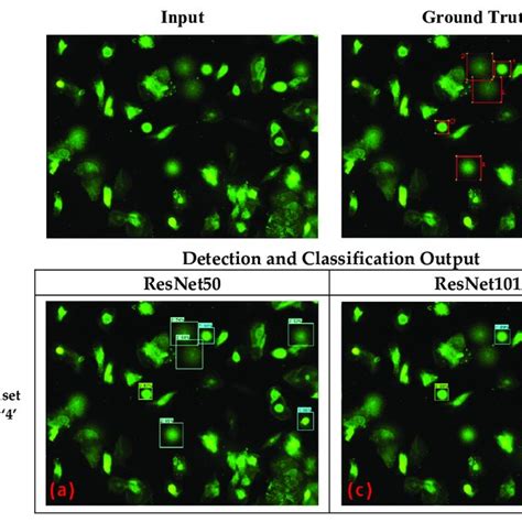 Non Augmented Dataset Vs Augmented Dataset Total Loss Comparation Cha Download Scientific