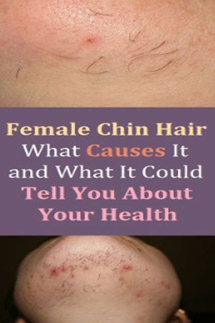 What Causes Female Chin Hair And What It Could Tell You About Your Health Adrienvhealth