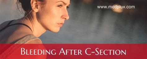 Bleeding After C Section How Long Will It Last Danger Signs