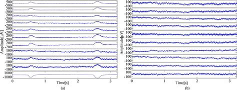 A Typical Example Of Real Eeg Signals Contaminated With Eye Blinks