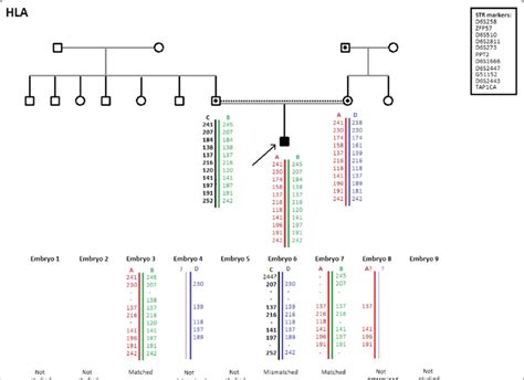 Haplotype Analysis For Str Markers In The Hla Loci Download