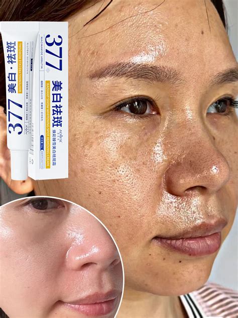 Рейтинг лучших кремов против пигментации на лице в аптеке — купить по