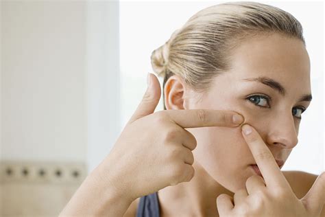 10 Effective Home Remedies For Pimples On Chin Smugg Bugg