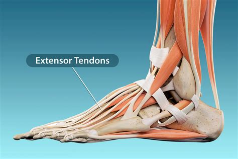 Foot Extensor Tendonitis Taping At Rosa Vega Blog