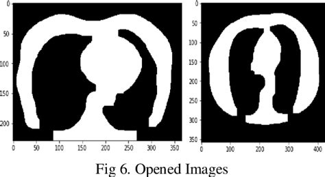 Figure 1 From Lung Cancer Detection Using Image Processing Techniques