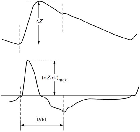 Minimally Invasive Cardiac Output Monitoring In The Year 2012 IntechOpen