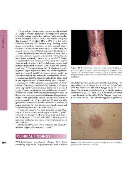 Dermatitis Numularis Pdf