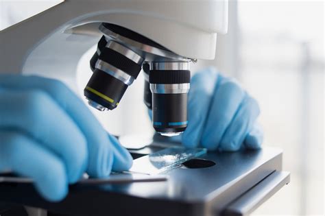 Vasculitis Prime Med Labs