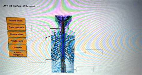Solved Label The Structures Of The Spinal Cord Brachial Plexus