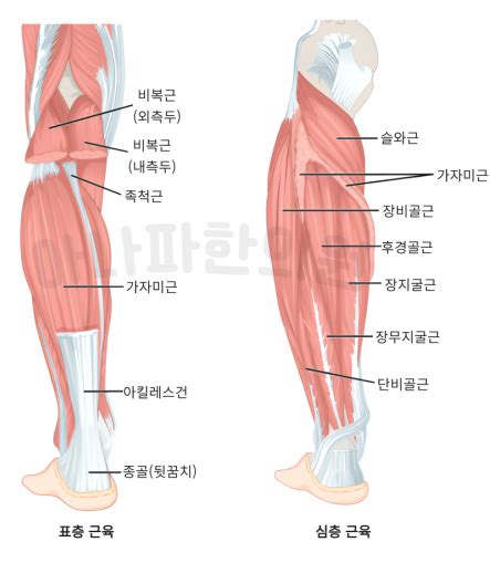 종아리 근육 파열 햄스트링