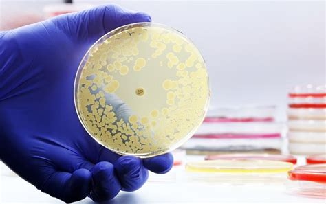 Sex Differences In Patients With Serious Bacterial Infections