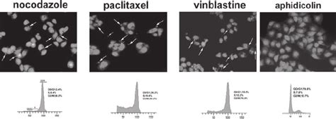 Microscopic Analysis Of Mn In Nocodazole Paclitaxel Vinblastine