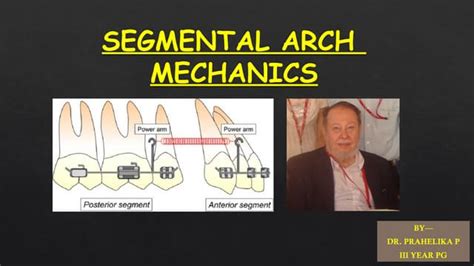 Segmental Arch Pptx