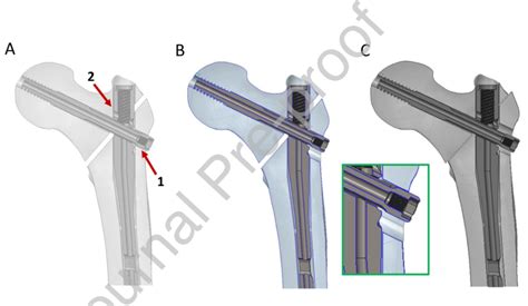 Principle Of Lateral Cortical Notching With The Example Of An Download Scientific Diagram
