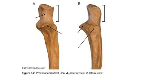 PROXIMAL END OF LEFT ULNA Diagram Quizlet