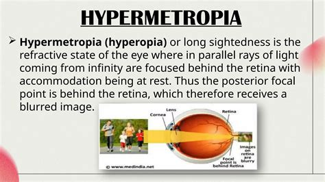 Refractive Errors Of Eye Myopia Hypermetropiapptx